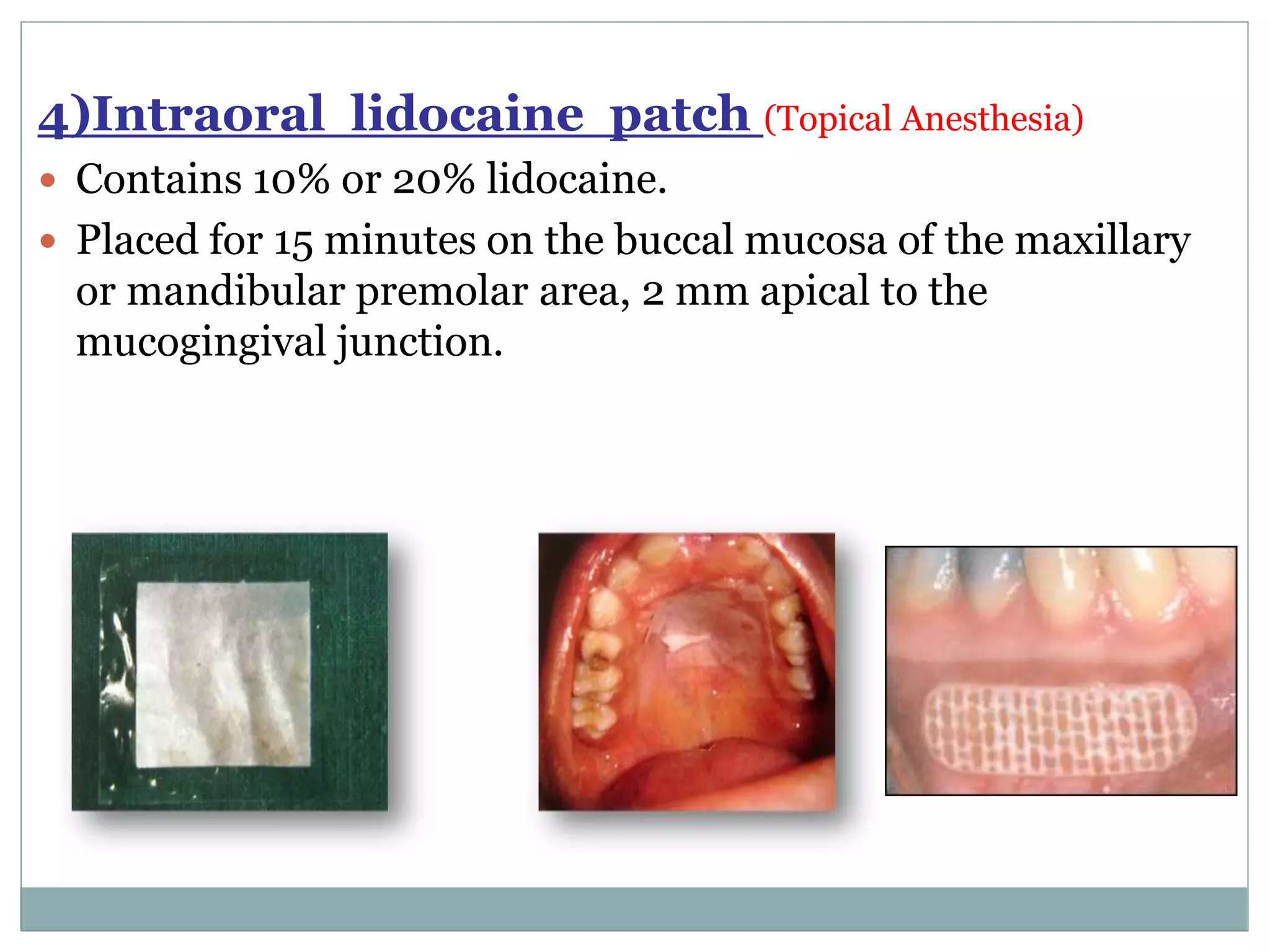 Local Anesthesia for pediatric dentistry | PPTX