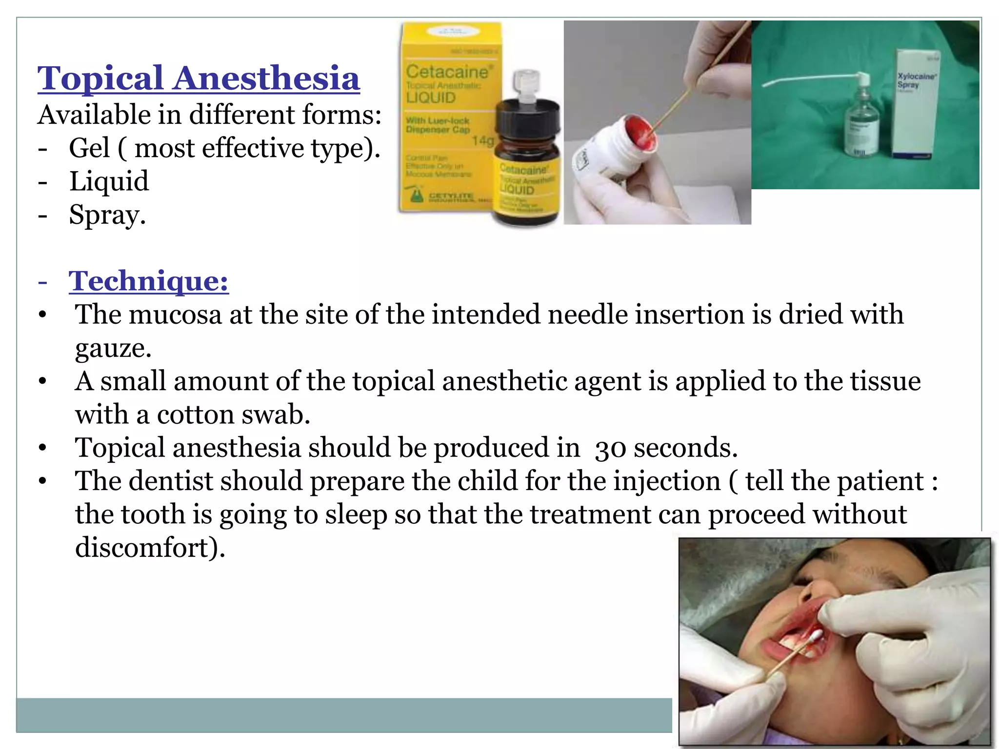 Local Anesthesia for pediatric dentistry | PPTX