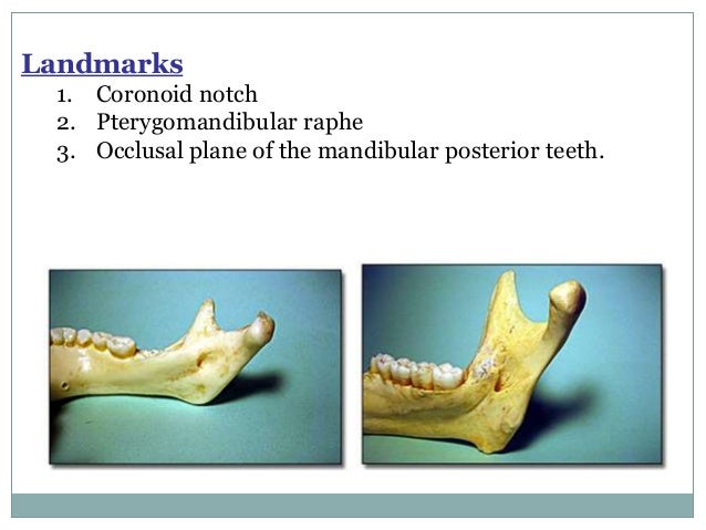 Local Anesthesia for pediatric dentistry