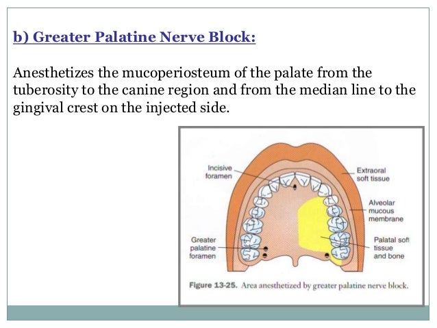 Local Anesthesia for pediatric dentistry