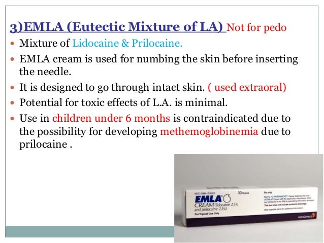 Local Anesthesia for pediatric dentistry