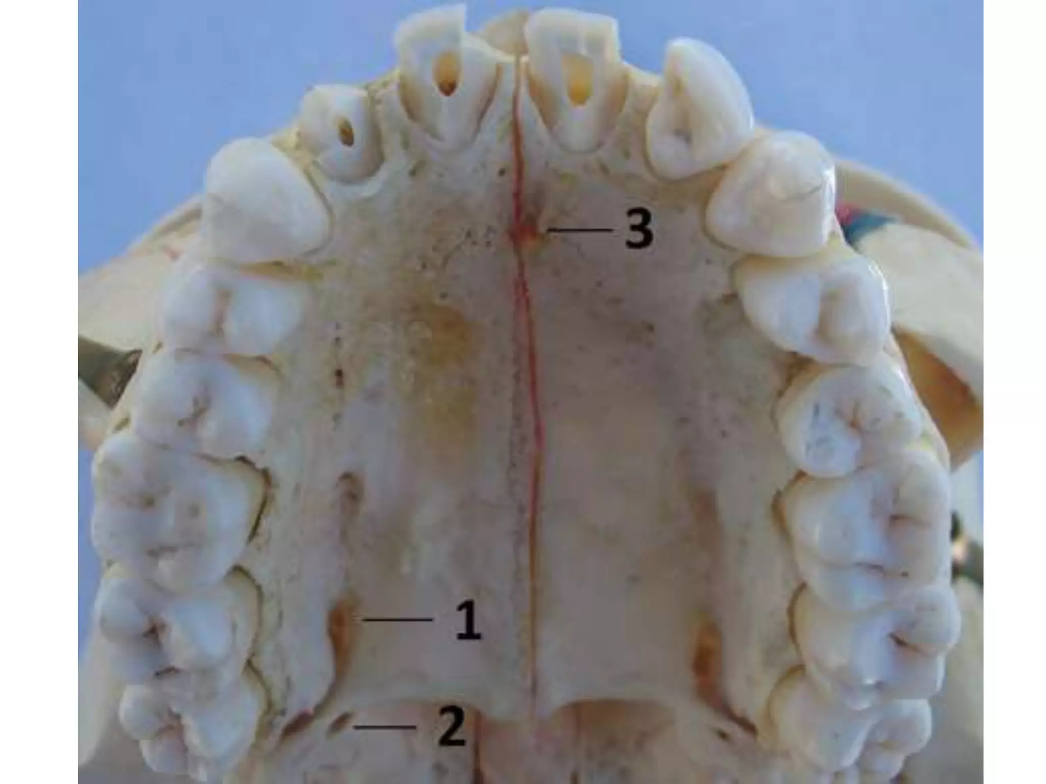 Innervation of teeth | PPTX