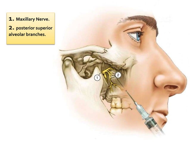 Innervation of teeth | PPTX