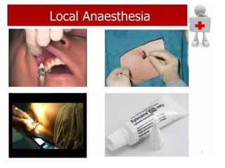 LA.pptx pharmacology local anesthetics agents | PPT