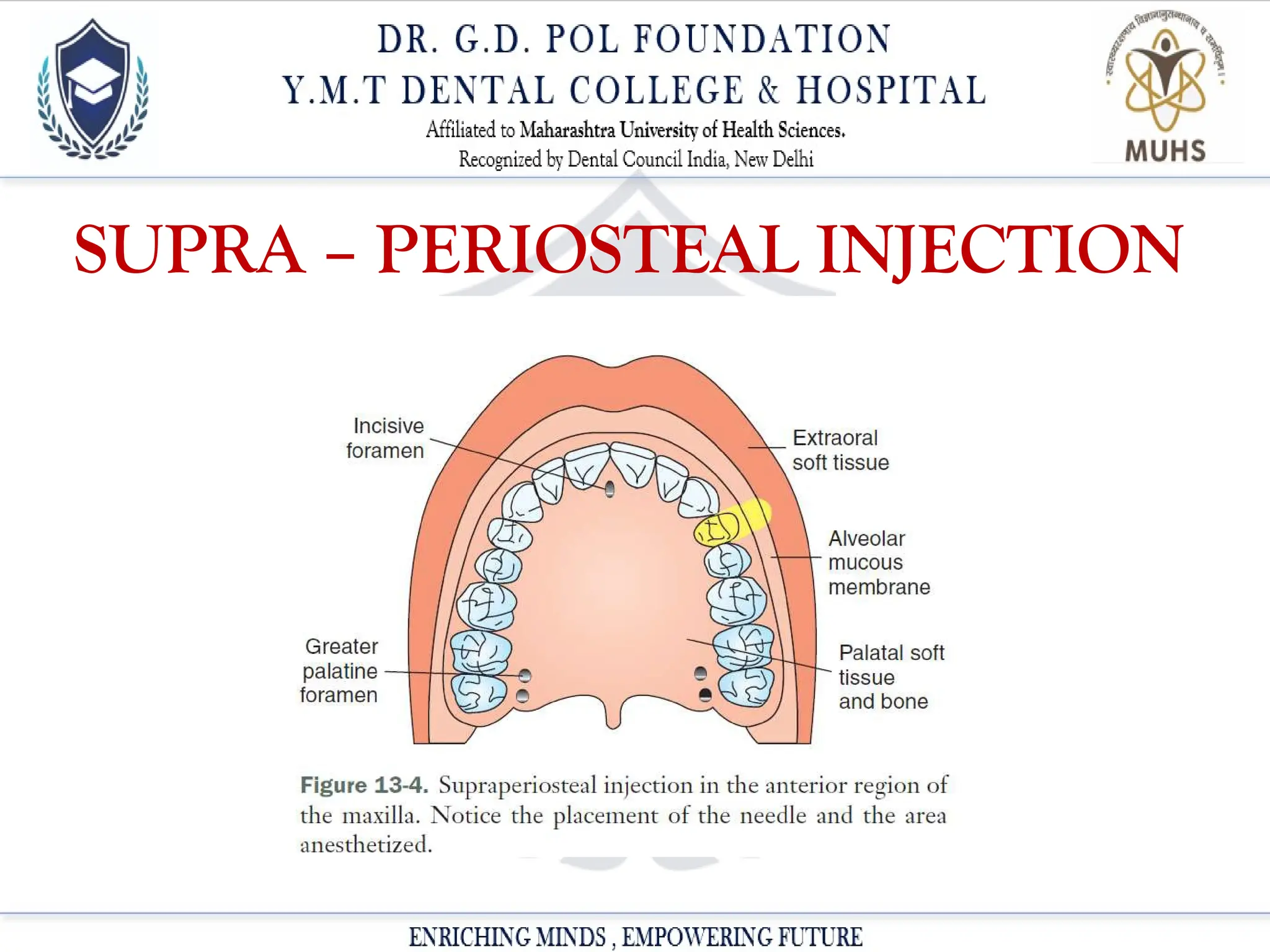 Local anesthesia powerpoint presentation.ppt