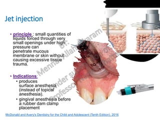 Local Anesthetic techniques for child dental patient.pptx