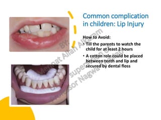 Local Anesthetic techniques for child dental patient.pptx