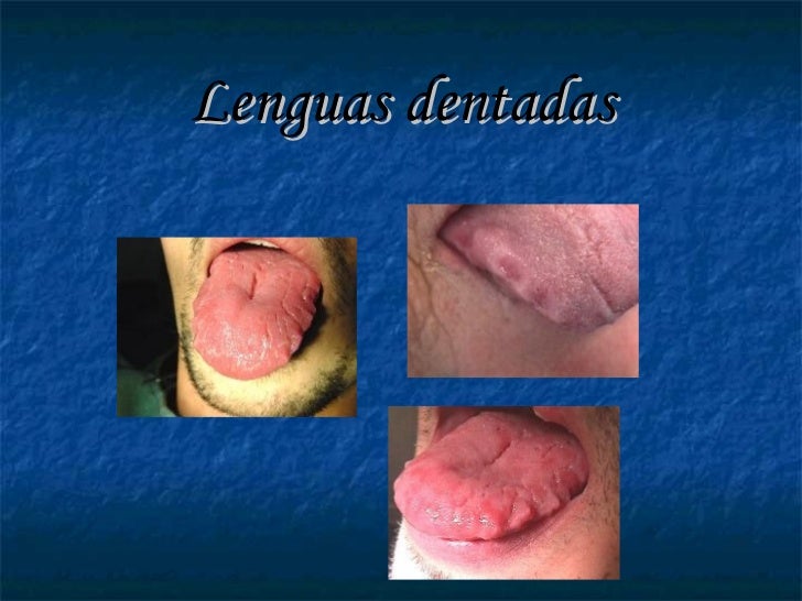 La Lengua Y Su Fisiologia