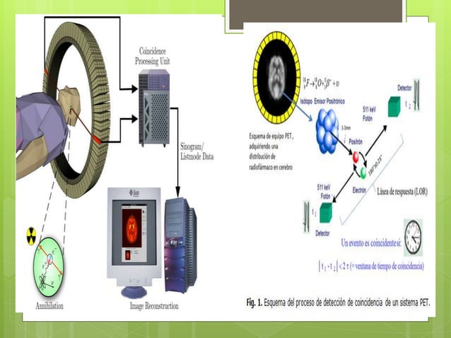 La tomografía por emisión de positrones neuropsicologia Psicofisiologia