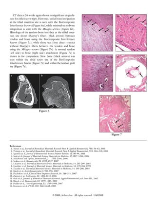 La0150 b arthrex biocomposite white paper - ib | PDF