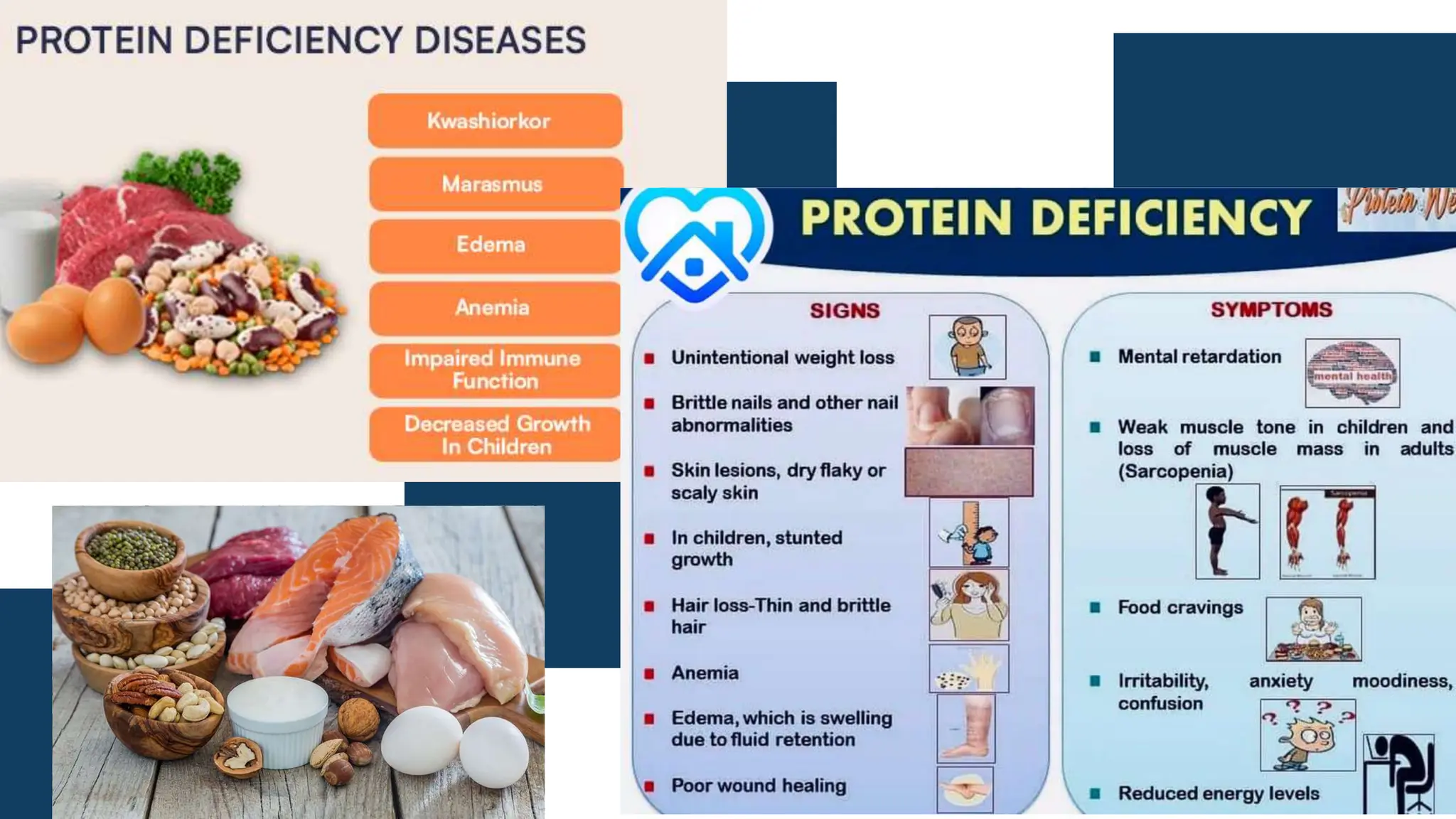 Proteins: An Overview explaining its classification, metabolism and ...