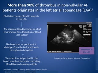 left atrial appendage closure with watchman device | PPTX