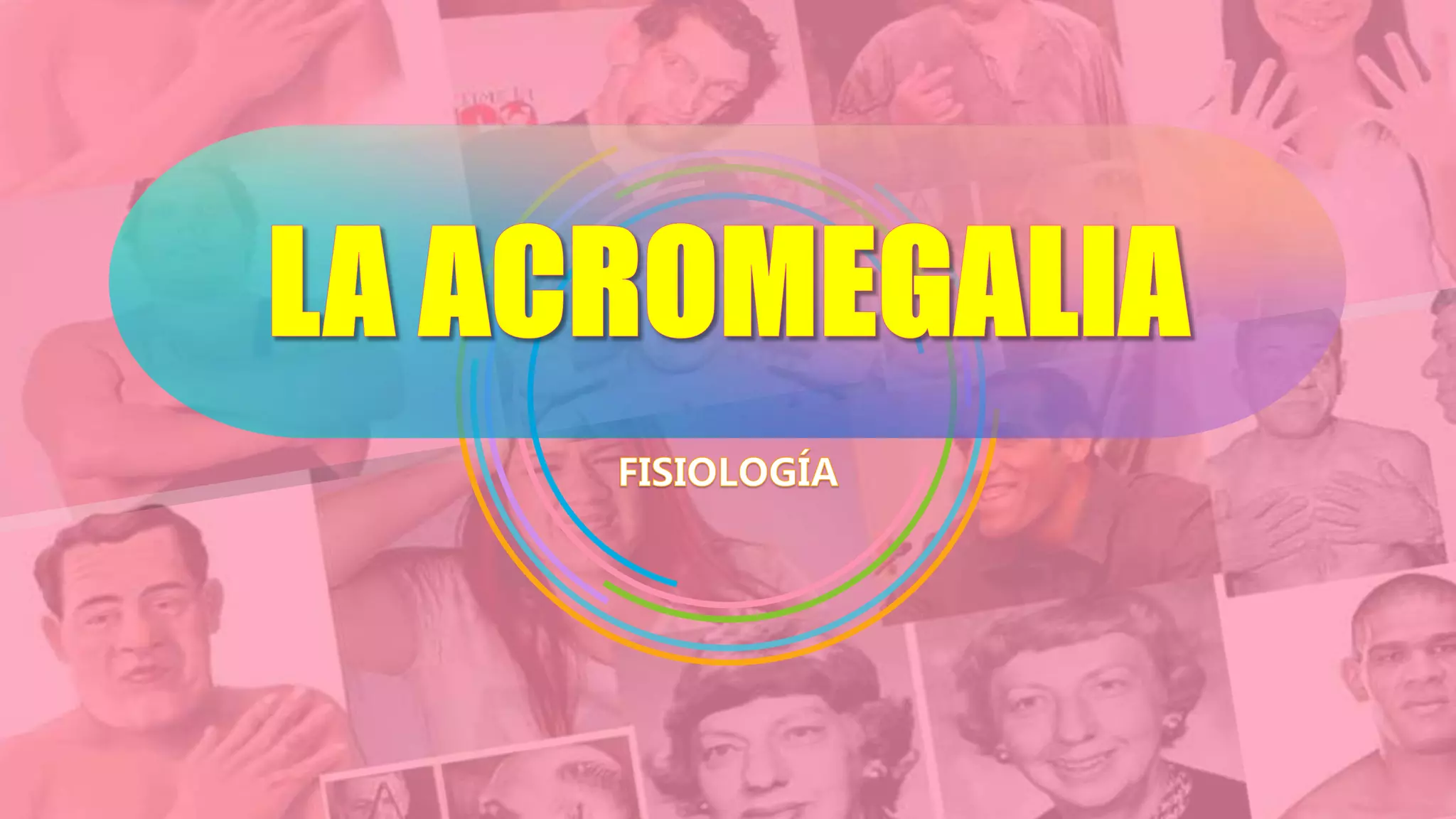 LA ACROMEGALIA - GIGANTISMO | PPTX