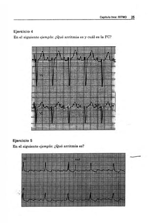 La alegría de leer el Electrocardiograma - Jorge Hernán López Ramírez ...