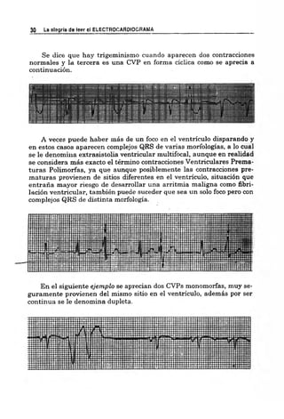 La alegría de leer el Electrocardiograma - Jorge Hernán López Ramírez ...