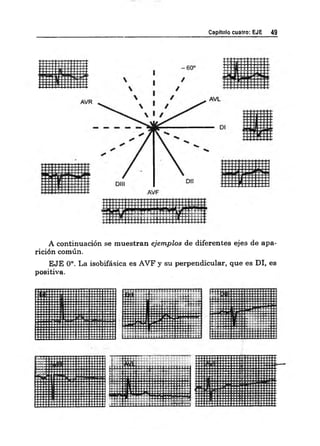 La alegría de leer el Electrocardiograma - Jorge Hernán López Ramírez ...
