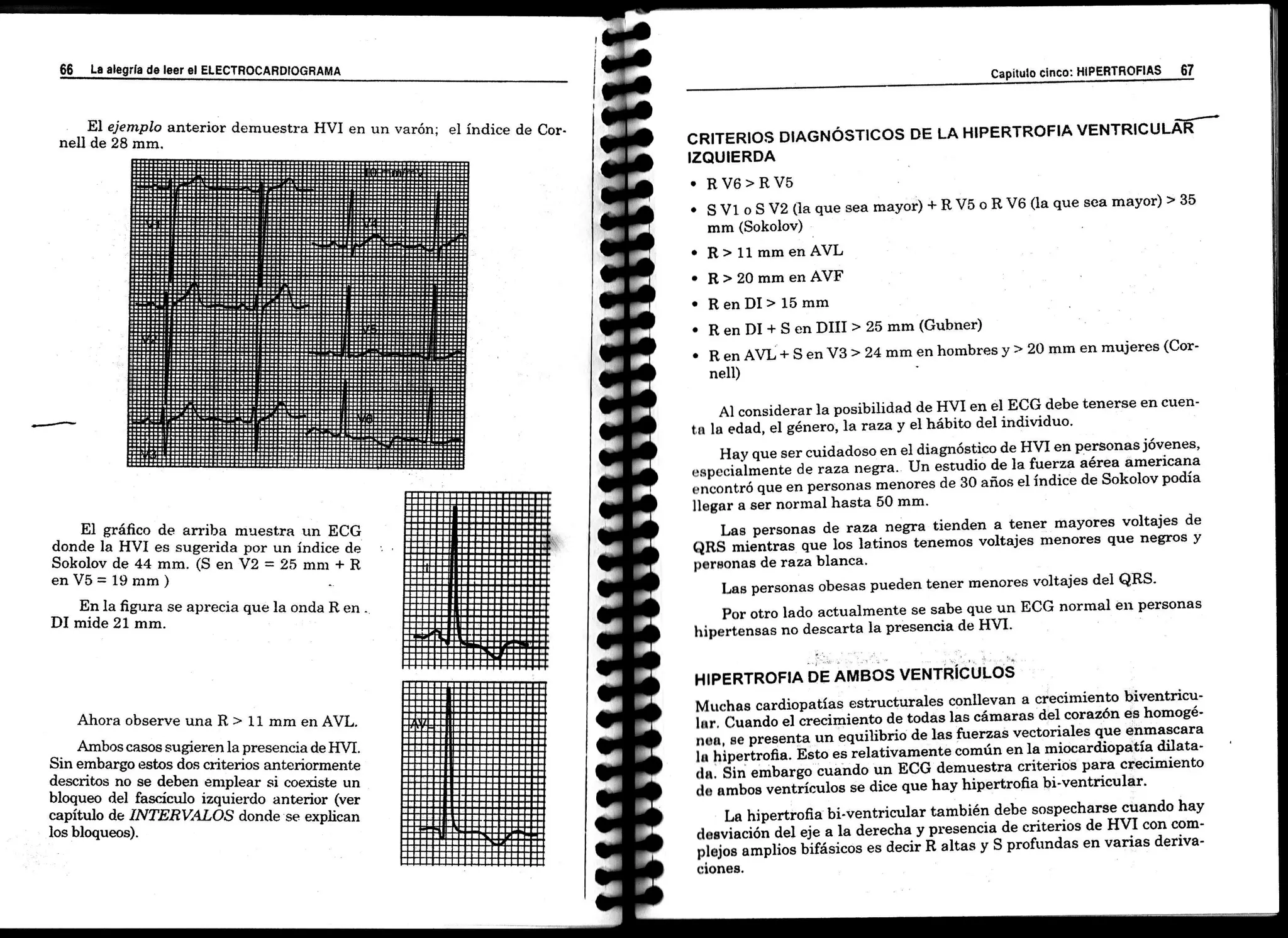 La alegria de leer Electrocardiograma 3ra edición | PDF
