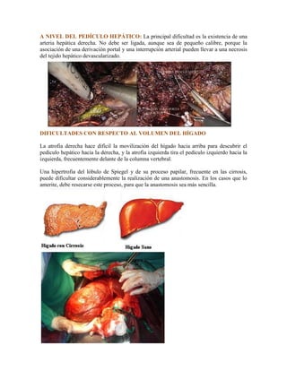 ANASTOMOSIS PORTO-CAVA | PDF