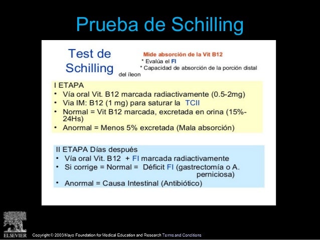La anemia en adultos enfoque contemporaneo