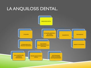 La anquilosis dental | ODP
