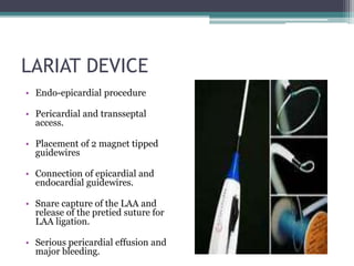La appendage closure devices,final (2) | PPTX