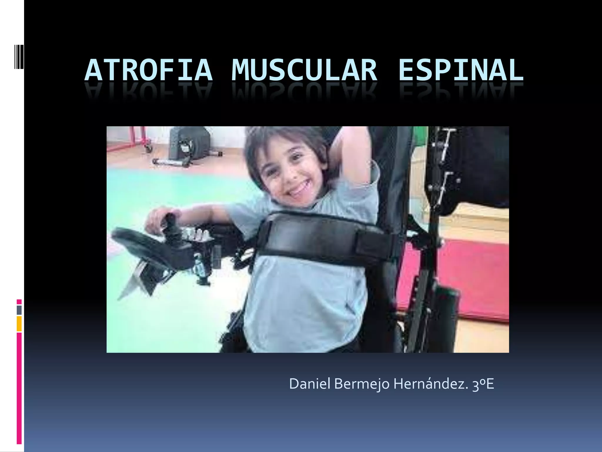 La atrofia muscular | PPTX