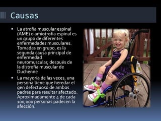 La atrofia muscular | PPTX