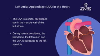 LAA Watchman | PPT | Free Download