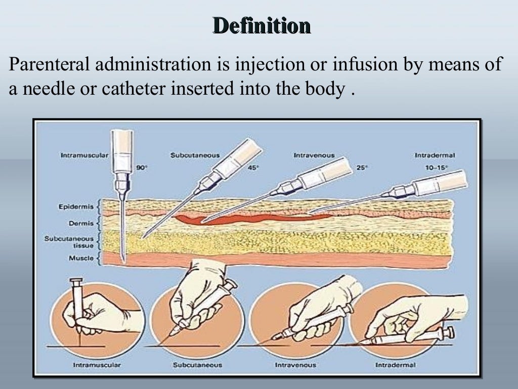 Fundamental of Nursing 7. : Parenteral Medication Administration