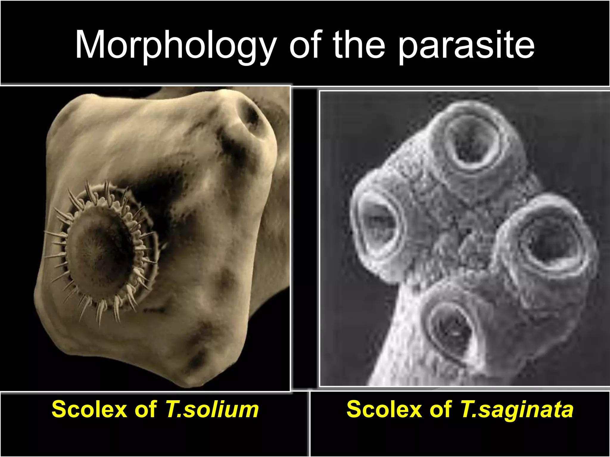 Laboratory diagnosis of Taenia species | PPSX