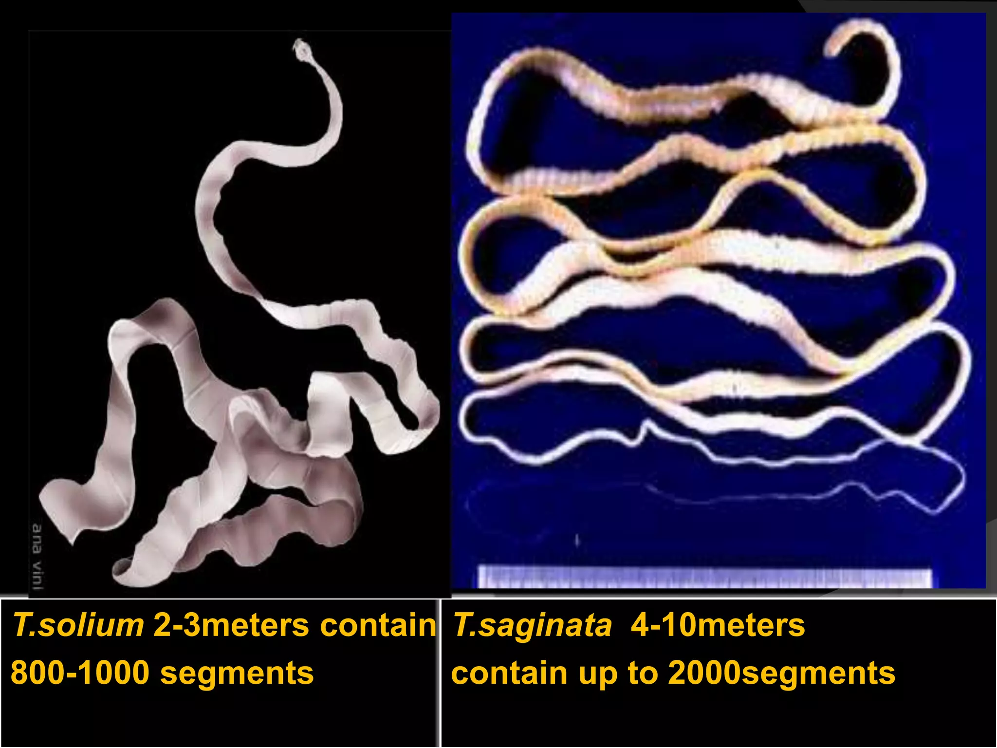 Laboratory diagnosis of Taenia species | PPSX