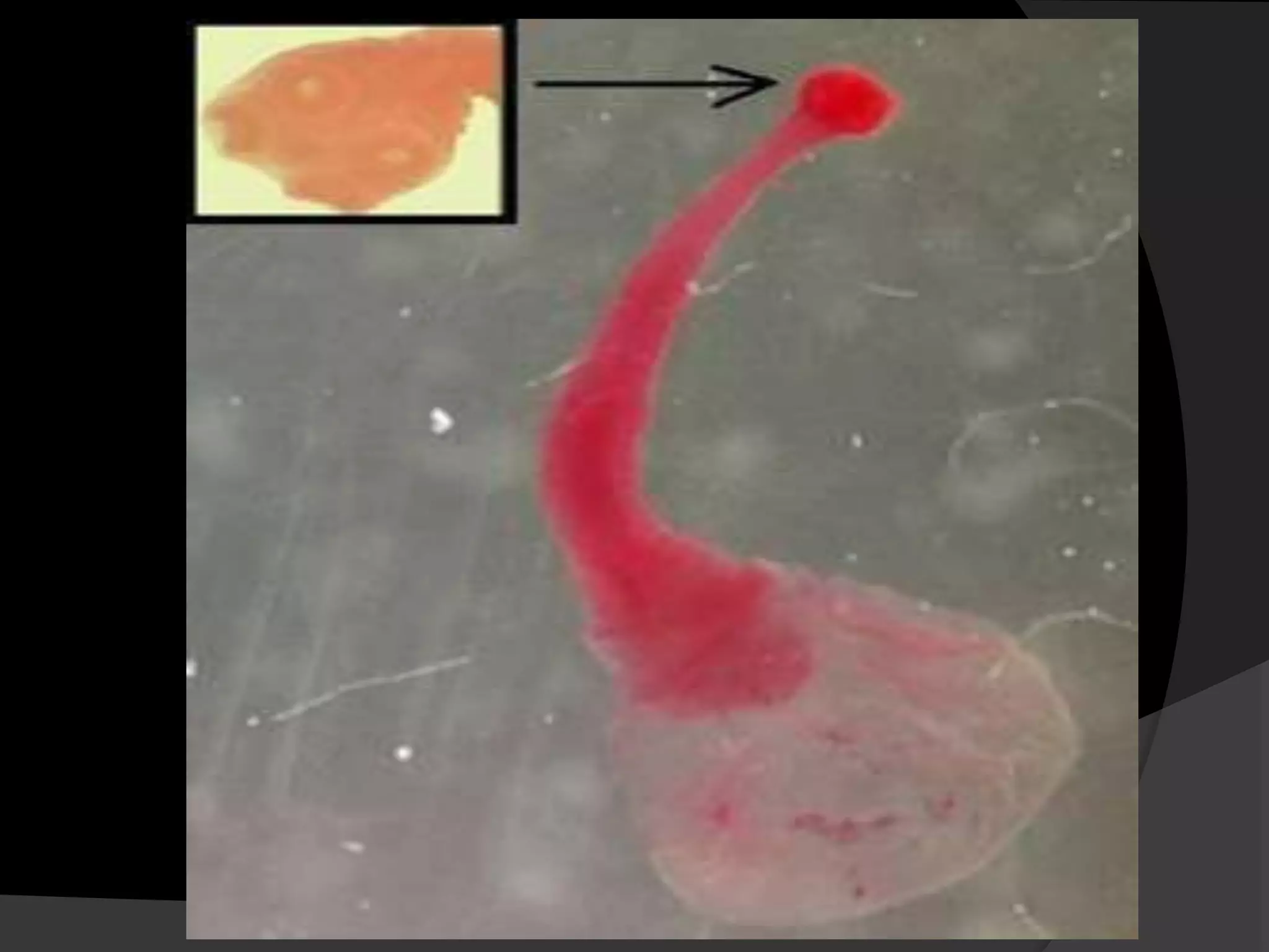 Laboratory diagnosis of Taenia species | PPSX