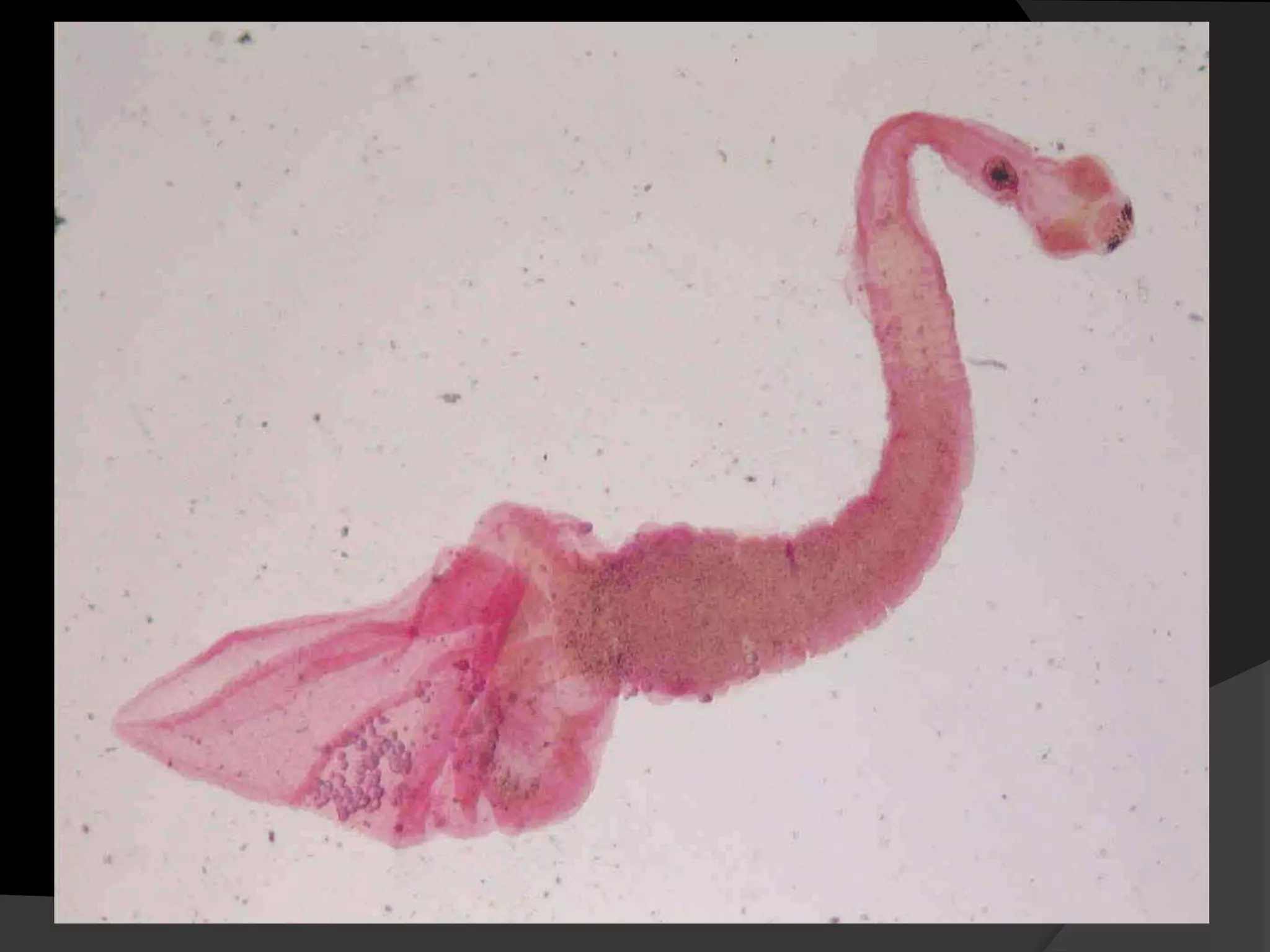 Laboratory diagnosis of Taenia species | PPSX