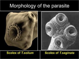 Laboratory diagnosis of Taenia species | PPSX