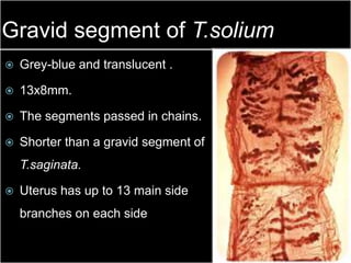 Laboratory diagnosis of Taenia species | PPSX