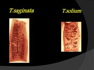 Laboratory diagnosis of Taenia species | PPSX