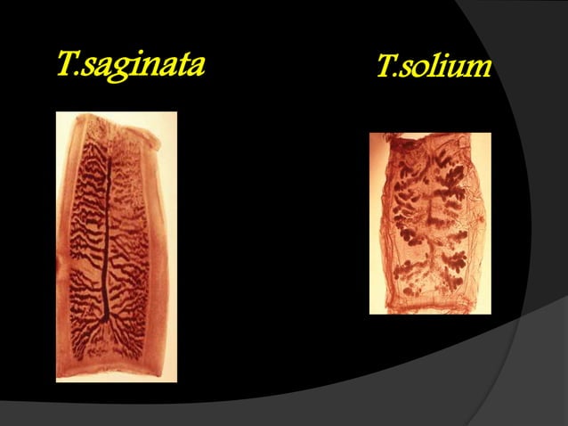 Laboratory diagnosis of Taenia species | PPSX | Medical Health