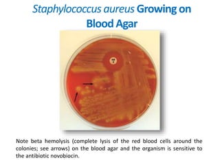 Lab. 2 Staphylococcus.ppt