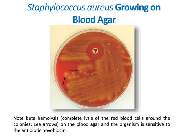 Lab. 2 Staphylococcus.ppt