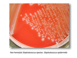 Lab. 2 Staphylococcus.ppt