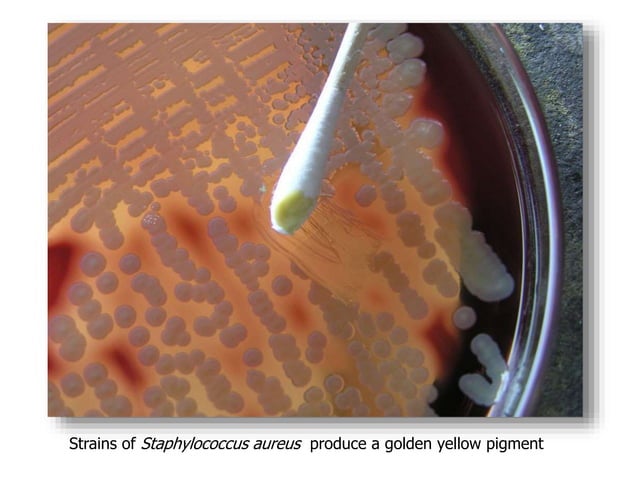 Lab. 2 Staphylococcus.ppt