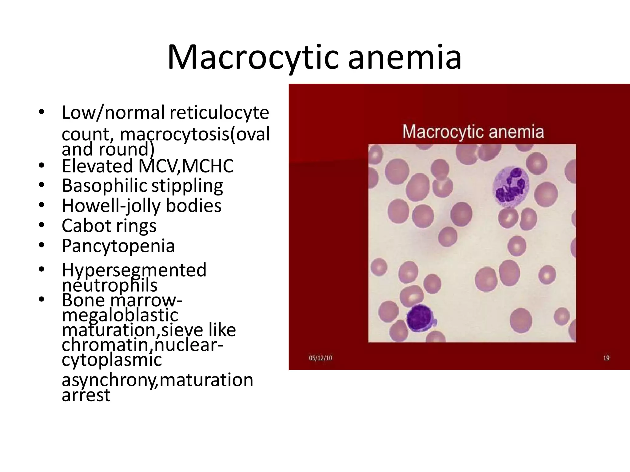 Lab. Diagnosis of Anemia.pptx