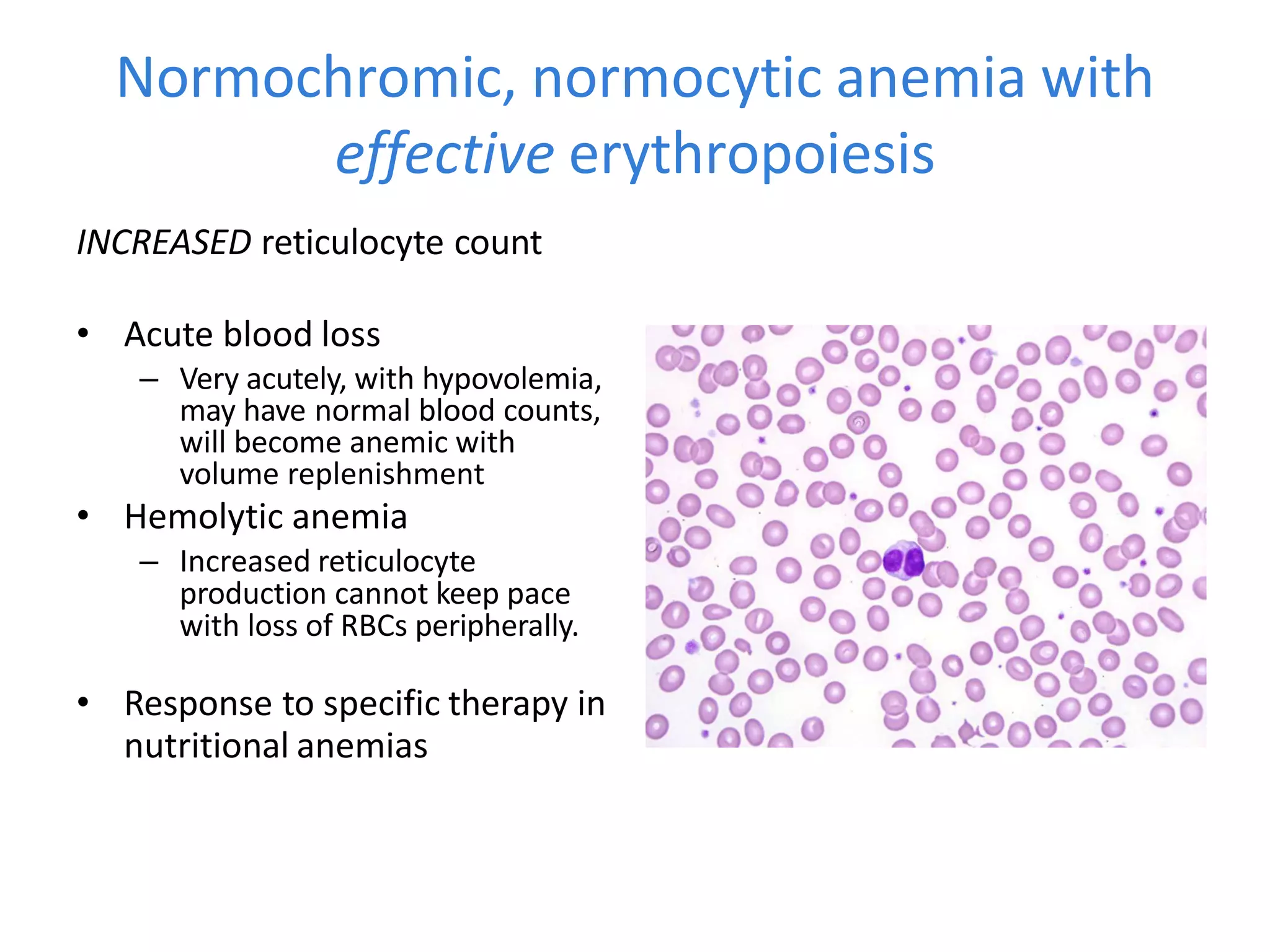 Lab. Diagnosis of Anemia.pptx