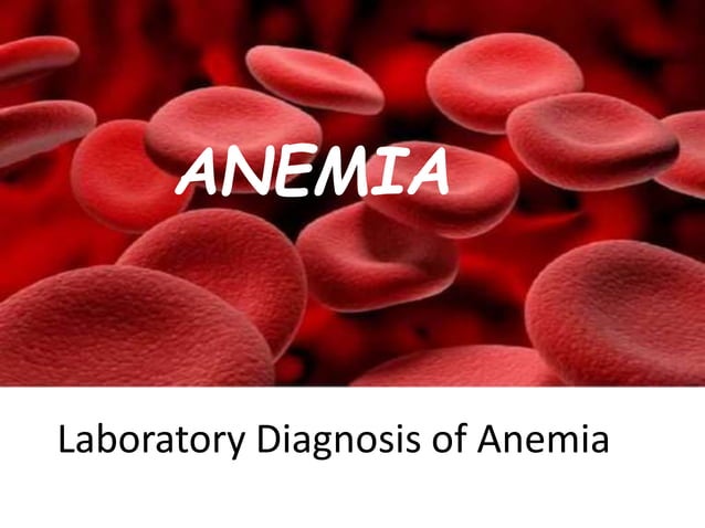 Lab. Diagnosis of Anemia.pptx | Blood Disorders | Diseases and Conditions