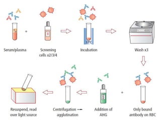 Lab-5-Coombs-Tests in detailed description | PPT