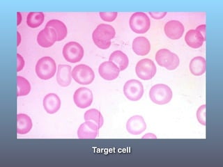 Lab Hemato Morphology Key | PPT