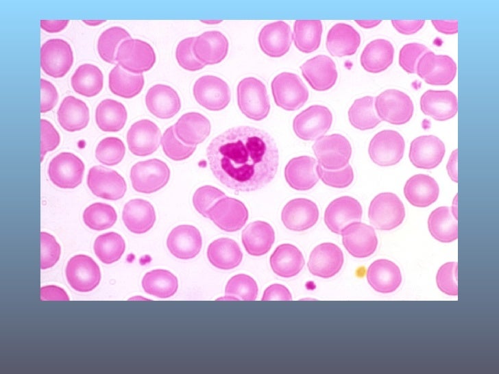 Rbc Pathology Normal Rbc Pbs Morphology Rbc Indices