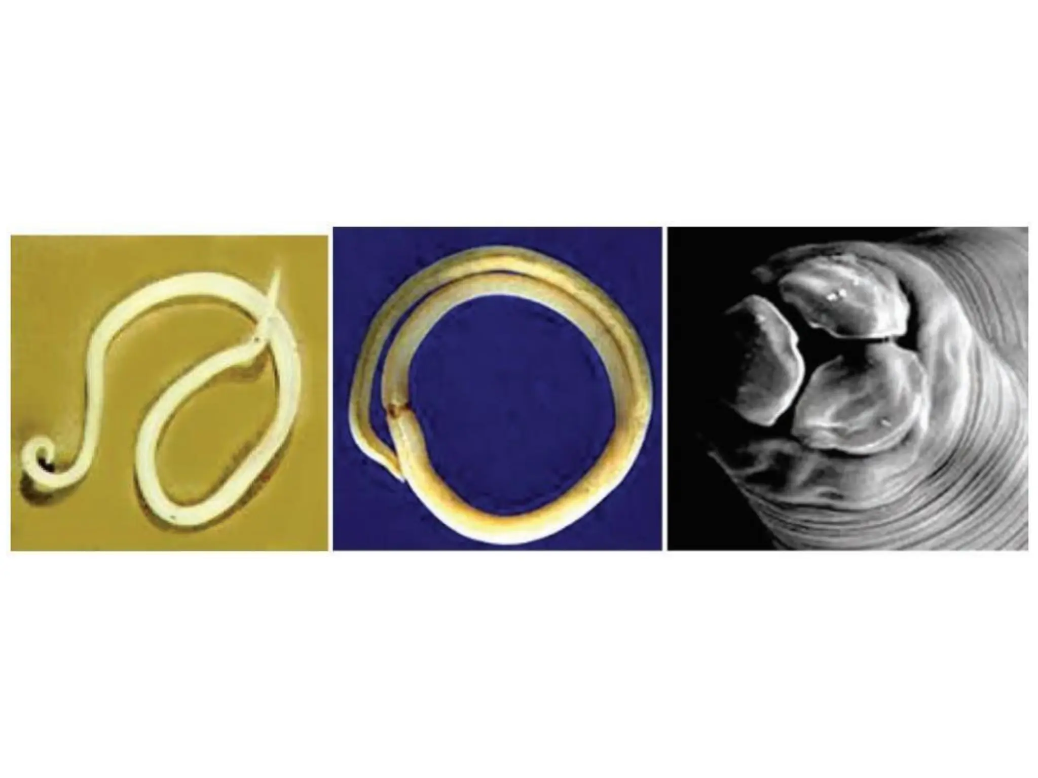 Overview of Intestinal Nematodes: Types, Life Cycle, and Diseases | PPT