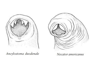Overview of Intestinal Nematodes: Types, Life Cycle, and Diseases | PDF