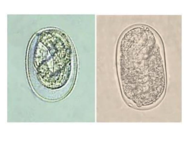 Overview of Intestinal Nematodes: Types, Life Cycle, and Diseases | PPT